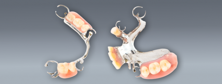 Partial Denture Solutions | Removable Partial Denture | Calgary Denture